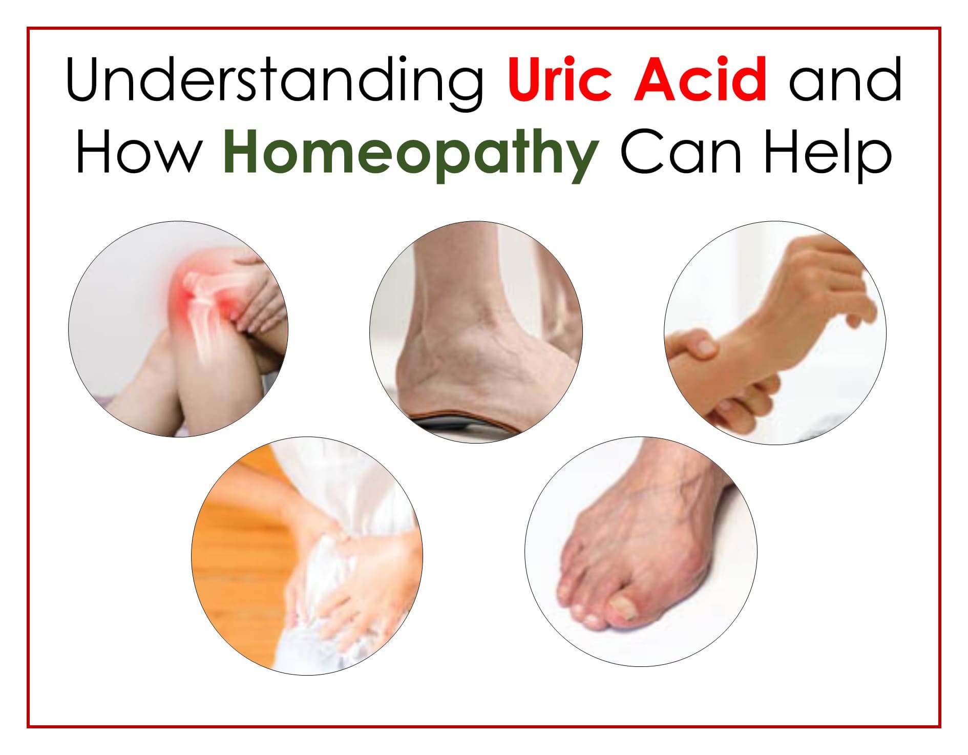UNDERSTANDING URIC ACID AND HOW HOMEOPATHY CAN HELP - Homeo Precision ...
